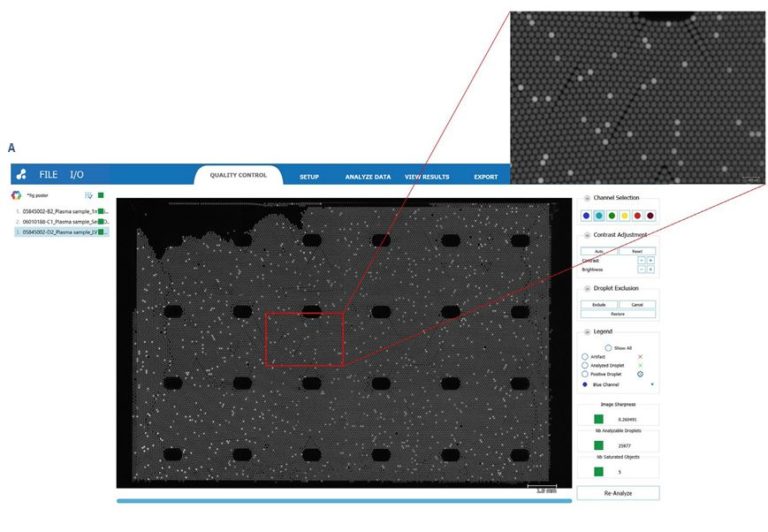 A streamlined workflow for liquid biopsy sample extraction and highplex ...